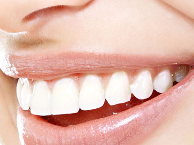 California Smiles – Patient Specials